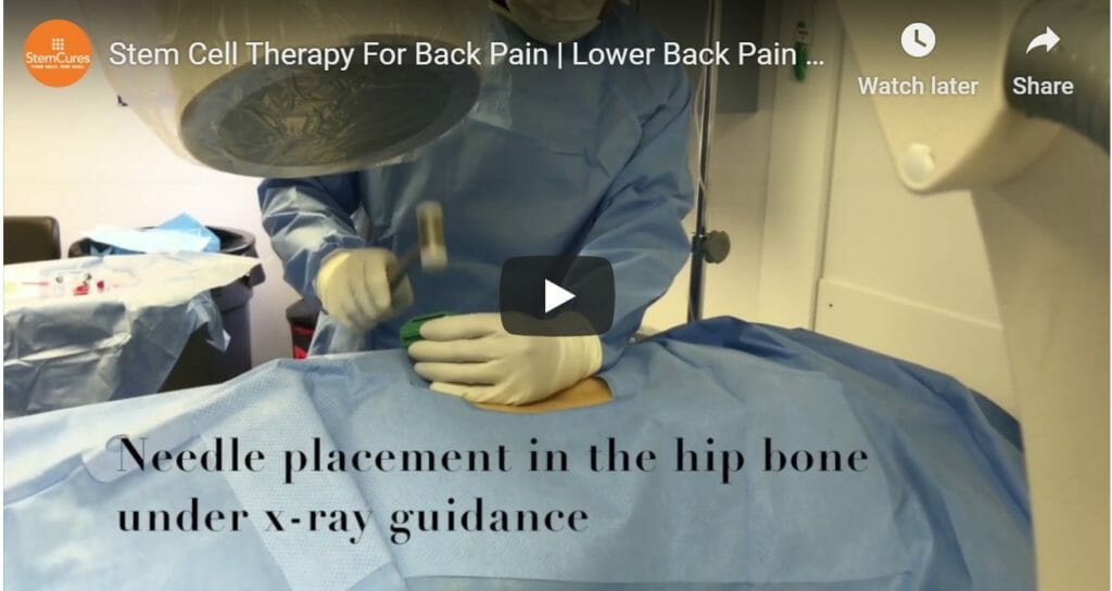 Cincinnati Stem Cell Therapy | StemCures